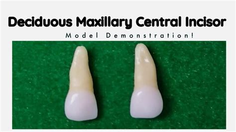 Dental Education Hub On Linkedin Deciduous Maxillary Central Incisor