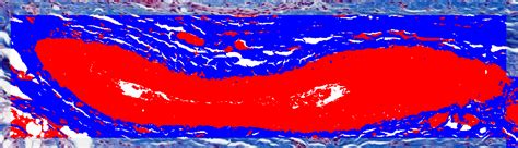 Pixel Classification To Object Detection Image Analysis Imagesc Forum