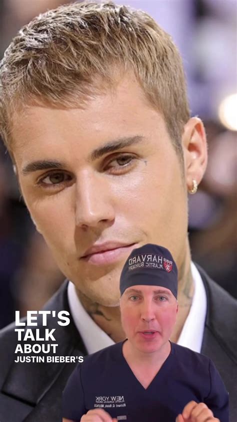 Justin Bieber Plastic Surgery Before After Nose Job Justin Bieber Is