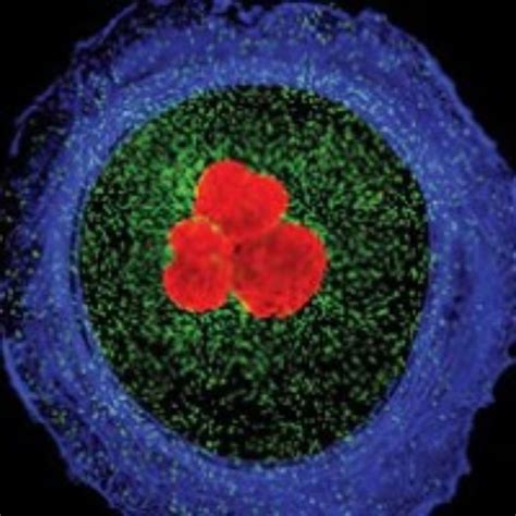 Stanford Researchers Discovered The First Human Bladder Cancer Stem