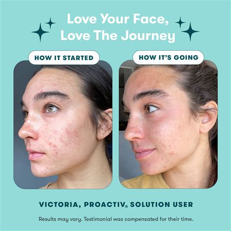 For All Skin Types Acne And Skincare Treatment Proactiv® Proactiv Us