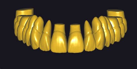 The Complete Set Of Gin Design Dental Libraries Exocad