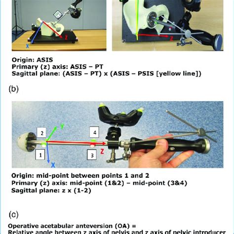A Segment Definition For The Pelvis B Segment Definition For The Download Scientific