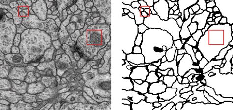 Figure 3 From Deep Contextual Networks For Neuronal Structure Segmentation Semantic Scholar