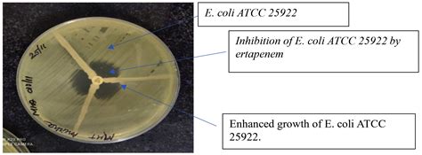 Comparison Of Three Phenotypic Methods Of Carbapenemase Enzyme Detection To Identify Carbapenem