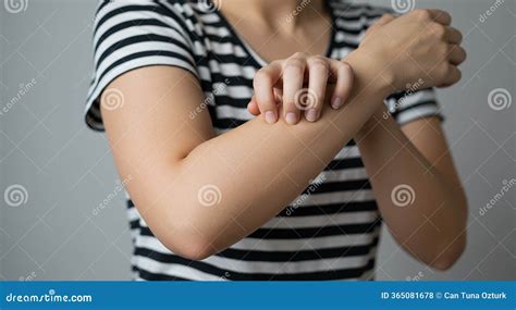 Arm Scratches Because Of Itching From Infection Fungus Or Tinea