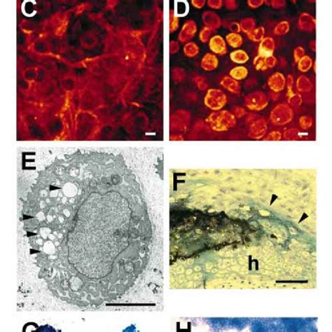 Evidence For Osteogenic And Chondrogenic Differentiation In Neural