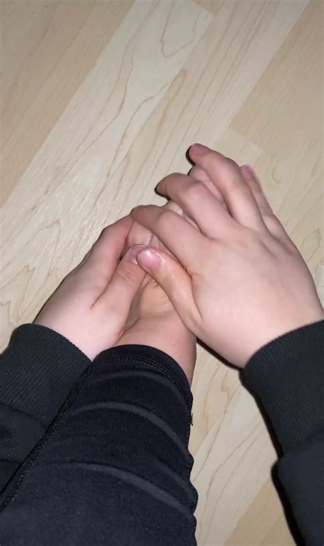 Partial Foot Amputee Girl Taking Off Silicon Prosthesis ThisVid Com