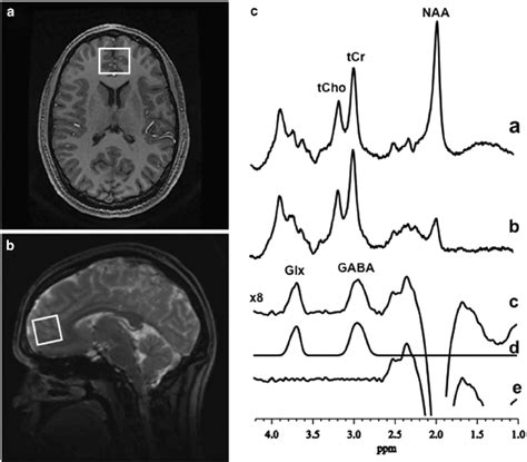 Electron Magnetic Resonance Spectroscopy At Erna Davila Blog
