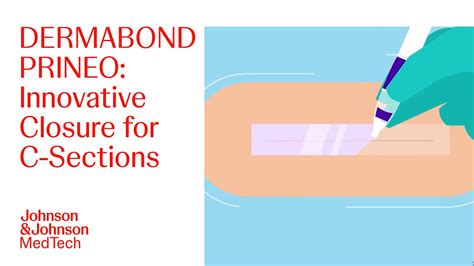 Dermabond C Section Pictures
