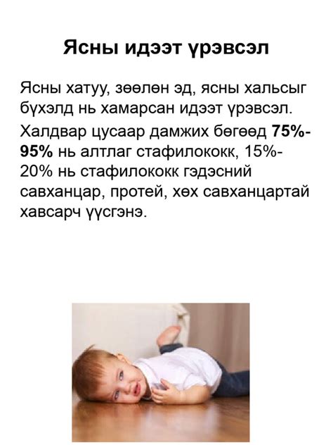 Ясны Идээт Үрэвсэл Pdf