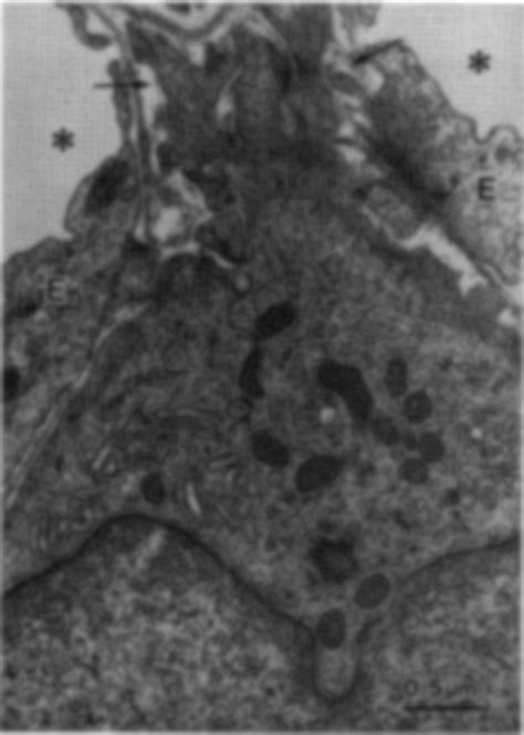 Electron Micrograph Of A Mesangial Cell Mesangial Cells Contain Bundles