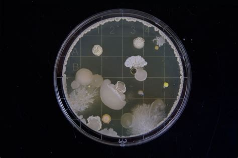 Widely Used Diabetes Drug Can Cause Flesh Eating Genital Infection