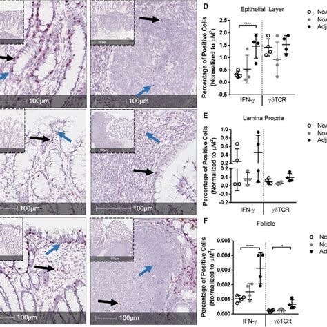 Increased Lymphoid Structures In Rectoanal Junction Of Vaccinated And