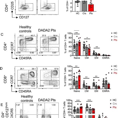 Ada2 Mutations Impede B Cell Development In The Bone Marrow At The Preb