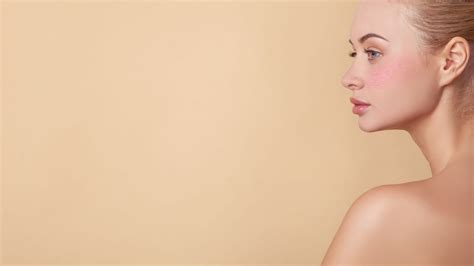 Cómo Cuidar De Tu Eritrosis E Intentar Disimular Su Intensidad Dermipedia