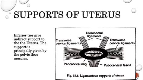 Retroverted Uterus Pptx
