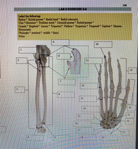 Solved Label The Following Scapula Spine Coracoid Proces