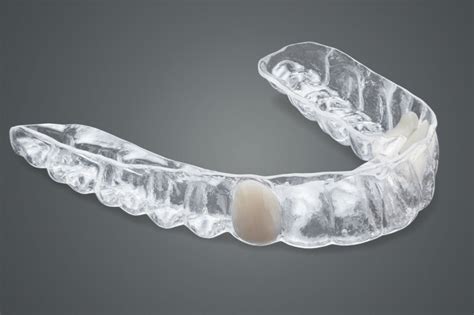 Bulk Invisalign Cleaning Tablets Manufacturer Private Label Oem