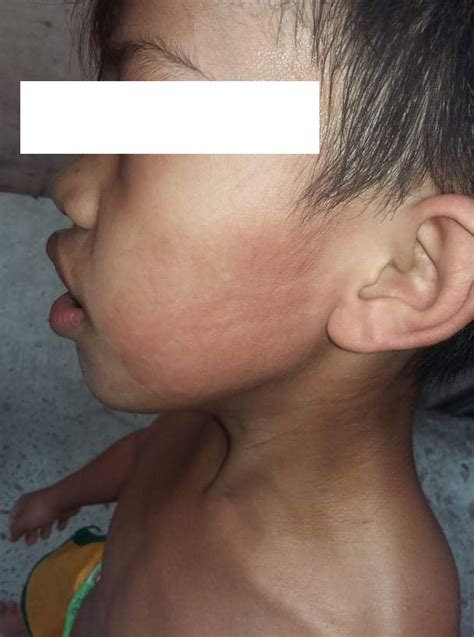 Isang Bata Sinampal Daw Ng Kapitbahay Dahil Lang Sa Pasong Nabasag