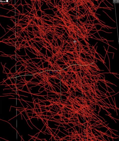 New Open Source Tool Helps To Detangle The Brain Mit News Massachusetts Institute Of Technology