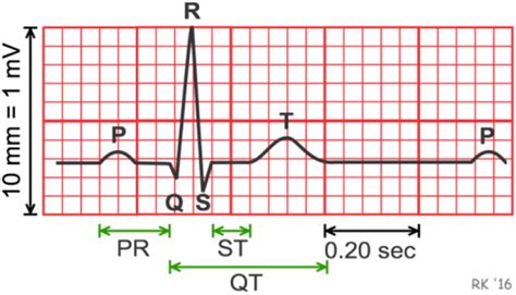 The Demonstration Of Ecg Parameters Download Scientific Diagram