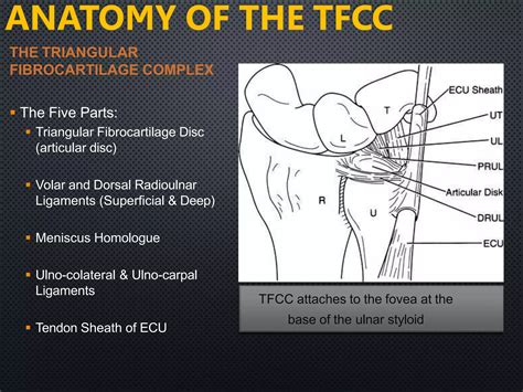 The Distal Radioulnar Joint And Tfccpptx