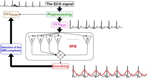 frontiers robust identification of the qrs complexes in electrocardiogram signals using