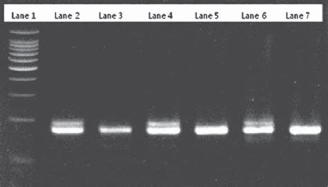 A Gel Electrophoresis Of Sex Specific PCR Products For Sex Download Scientific Diagram