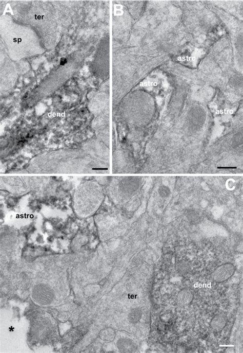 LOC689986 Localises To Neuronal Dendrites And Small Astrocytic Download Scientific Diagram