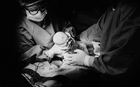 Nuchal Cord Complications And Long Term Effects