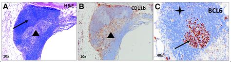 Inhaled Submicron Particle Paclitaxel Nanopac Induces Tumor Regression And Immune Cell