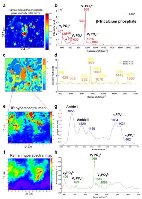 A Raman Map Of Breast Tissue Section At The Phosphate Peak Intensity
