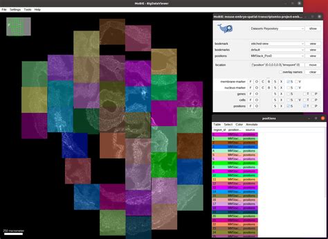 Spatial Transcriptomics Mobie