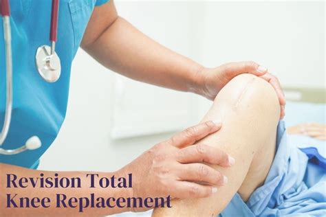 Expert Revision Total Knee Replacement By Dr Arun Reddy Mallu