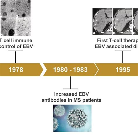 Primary Acute Epsteinbarr Virus Ebv Infection Leading To