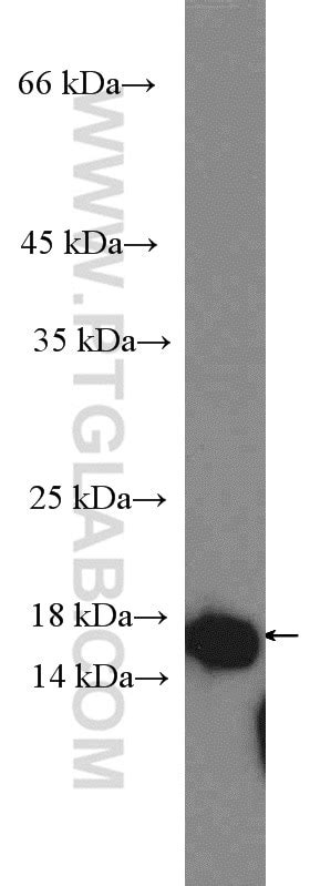 Pdcd6 Alg2 Antibody 12303 1 Ap Proteintech
