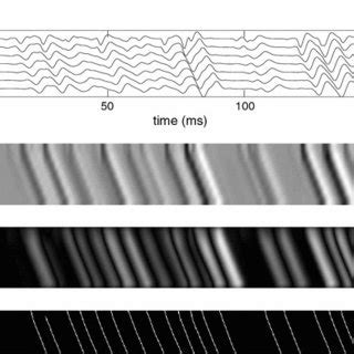 Steps Of The Proposed CV Estimation Algorithm A 150 Ms Segment Of A Download Scientific