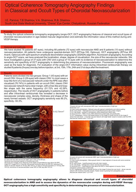 Pdf Optical Coherence Tomography Angiography Findings In Classical