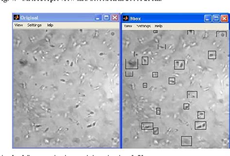 Figure 4 From Multimoving Human Sperm Tracking Using Cgm Cs Approach And Comparative Analysis