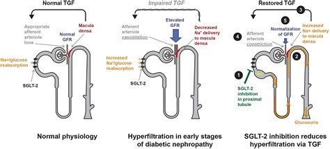 Sglt2 Inhibitors A Narrative Review Of Efficacy And Safety
