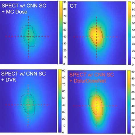 An Example Slice Of SPECT CT Along With Dose Rate Maps Of A Virtual Download Scientific
