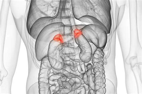 50 Facts About Cushing Disease