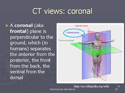 10 Planning Ebustbna Of Subcarinal Lymph Node Station