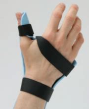 Extensor Tendon Injuries Of The Hand Physiopedia