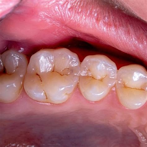 Ashtead Dental Blogs Oral Health Tips Treatments And Advice