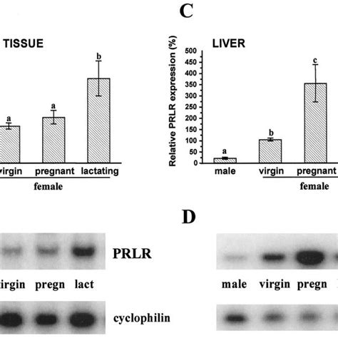 Analysis Of Prl Gene Expression By Rt Pcr Lane 1 1 Kb Dna Ladder Download Scientific Diagram