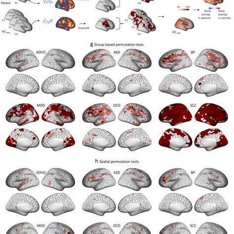 Functional Circuit Heterogeneity Of Extreme Negative Gmv Deviations In