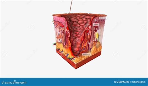A Third Degree Burn Will Damage All Of The Layers Of The Skin The