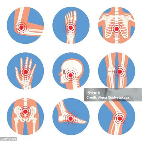 엑스레이 보기에 인체의 부분 골격 통증이 있는 인체 부위의 다양한 엑스레이 촬영 원형 모양의 만성 해부학 신체 손상 벡터 일러스트 레이 션 X 레이에 대한 스톡 벡터 아트